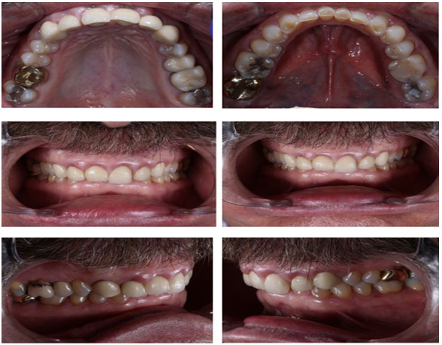 JCRMHS-V4-1187 - JCRMHS (ISSN 2832-1286)